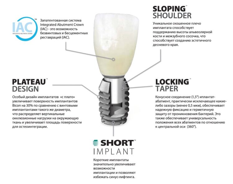 Pros and cons of dental implants – Advantages and disadvantages of ...